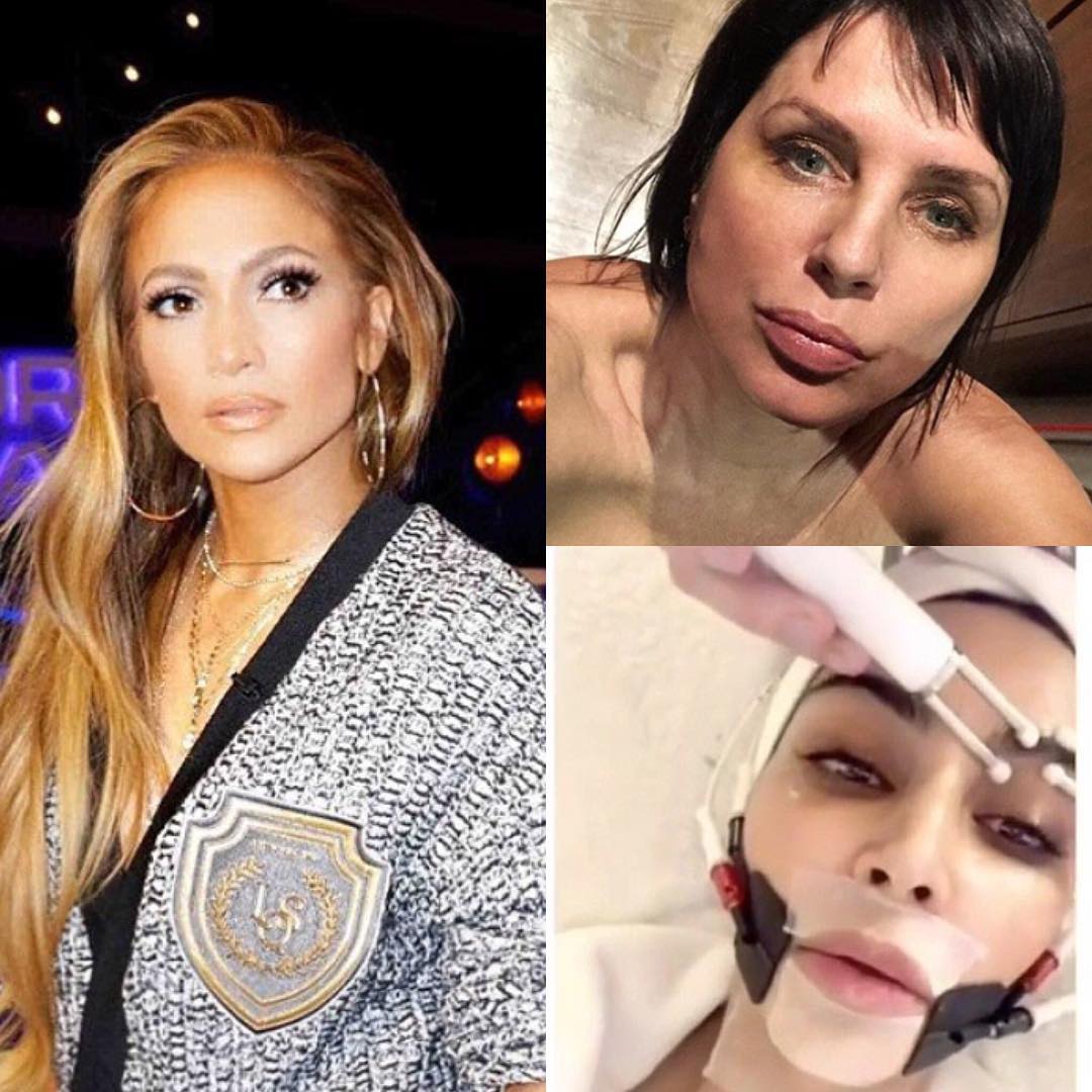 As Seen In Hood | CACI Beauty