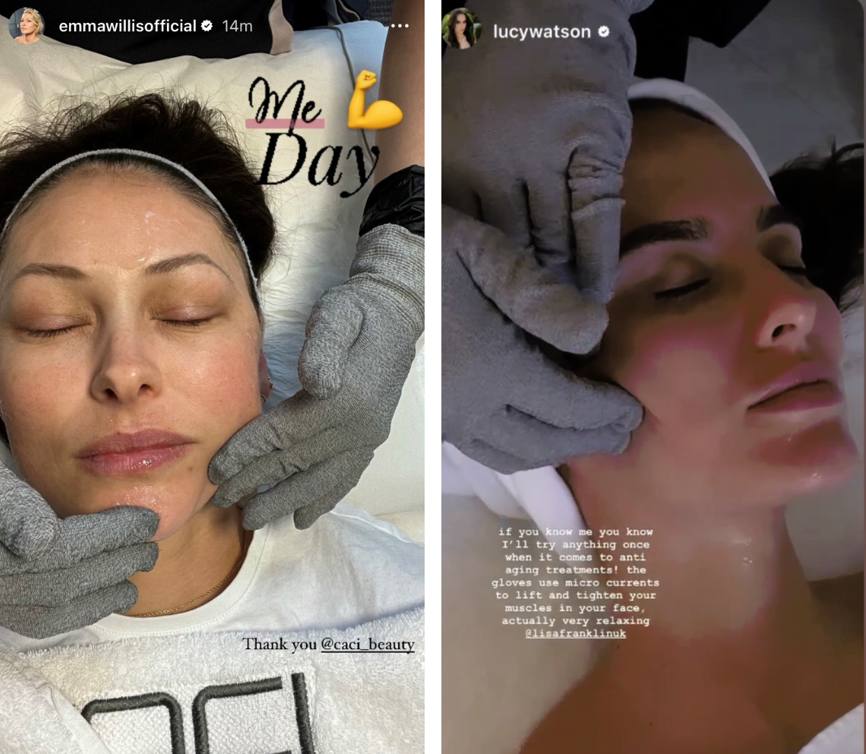 CACI’s New Micro-Touch Facial – Celebrity Approved | CACI Beauty