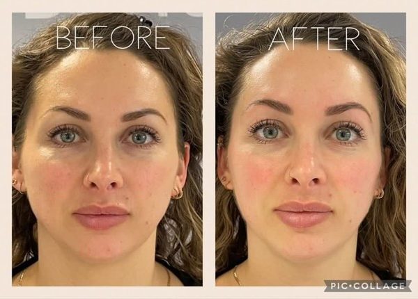 Introducing CACI’s NEW Micro-Touch Facial | CACI Beauty